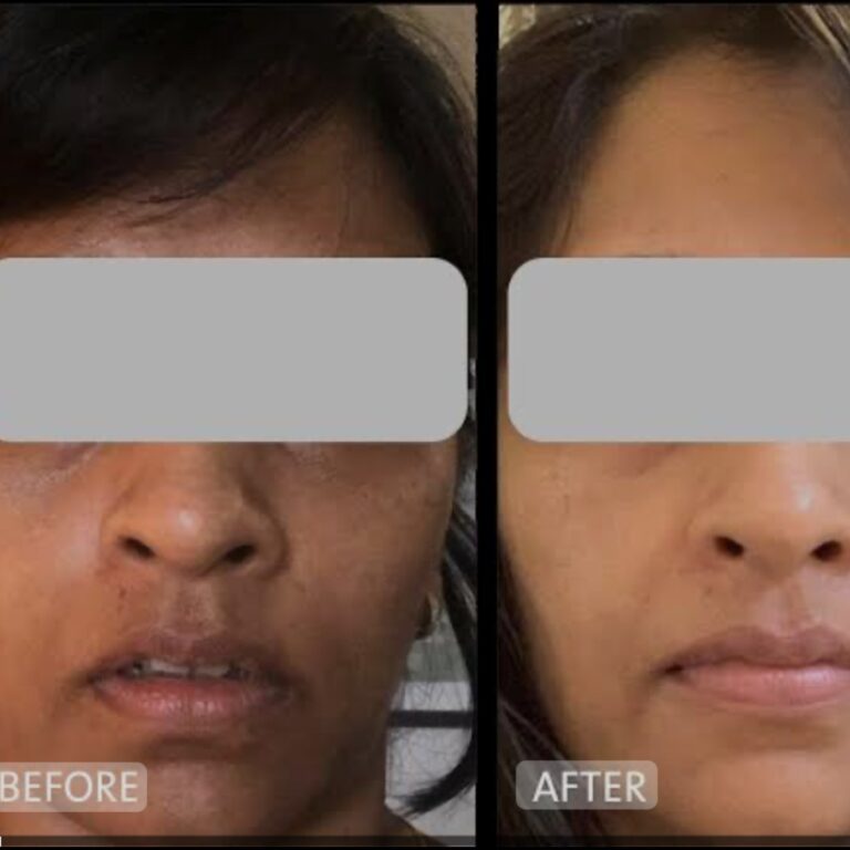 Gallery - Advanced Dermal Institute