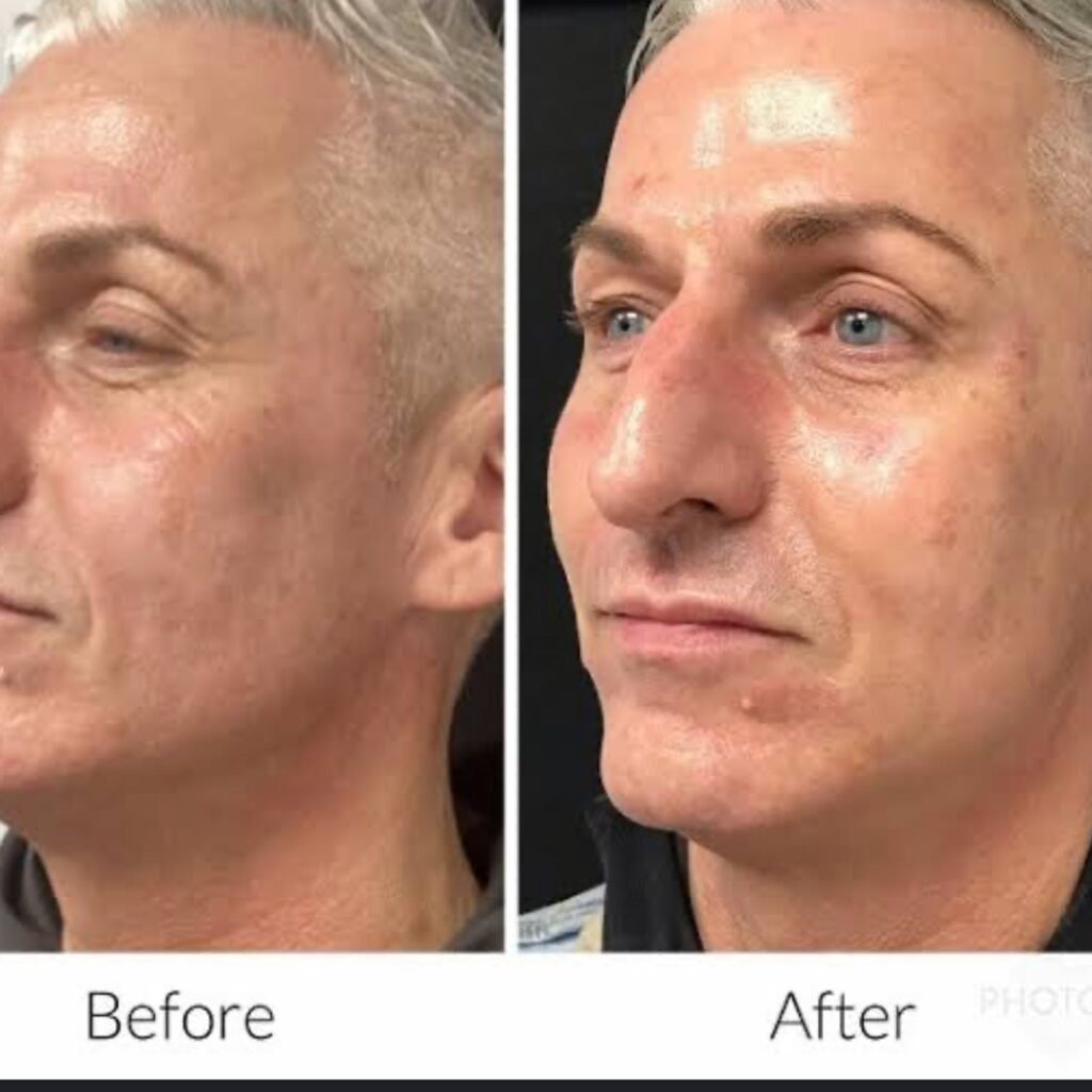 Gallery - Advanced Dermal Institute