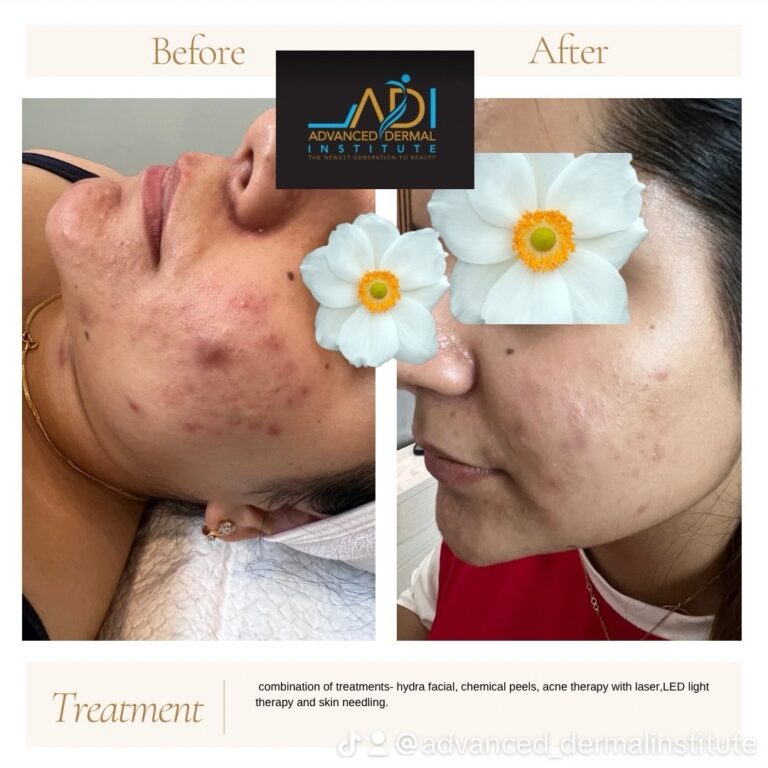 Gallery - Advanced Dermal Institute